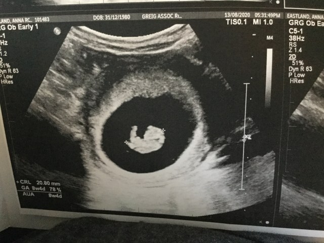 Welcome, Baby Timbit – Just East Of Crazy Land